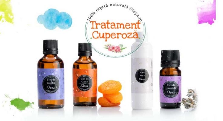 Tratament natural cuperoza recomanda de FARMACIST - Retena BIO